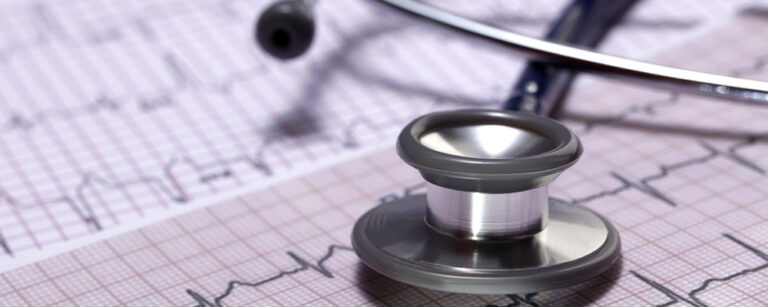 Ηλεκτροκαρδιογράφημα | Τι είναι και πώς γίνεται;